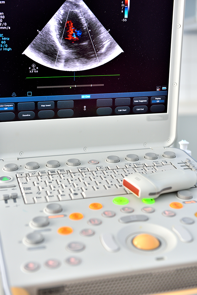 ECHOCARDIOGRAPHY - Assuta